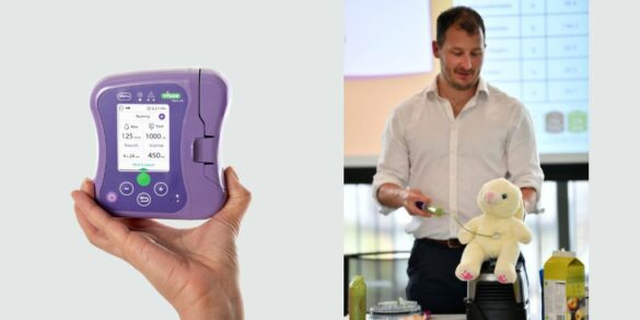 New enteral feeding pump will open up access to blended diet – as ...